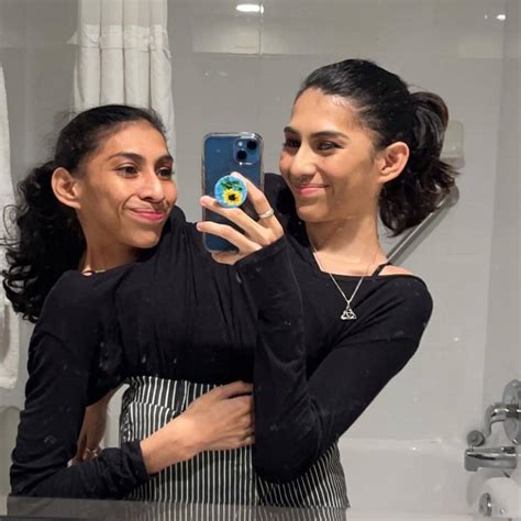 Conjoined Twin Answers The One Question Everyone Wants To Know