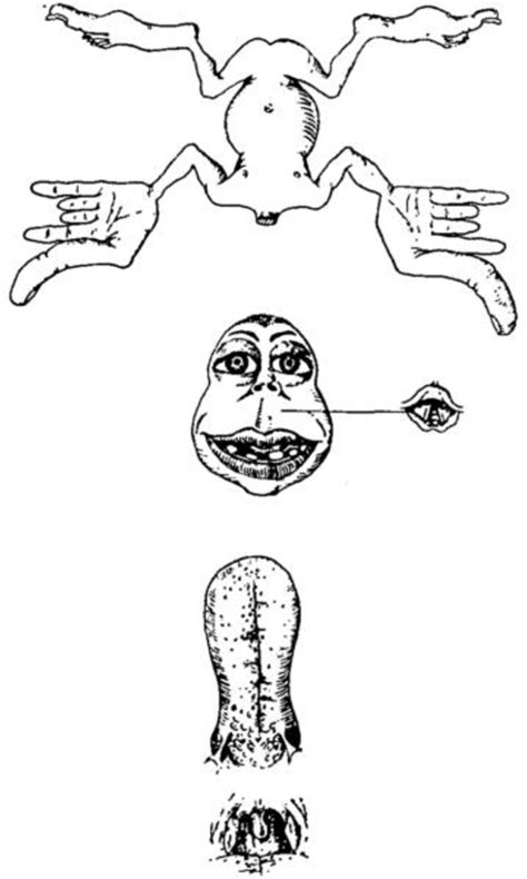 Figure 3 From Motor Areas In Patients With Motor Eloquent Brain Tumors Insights Derived From