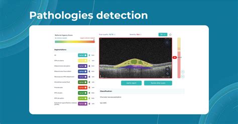 Our Blog Artificial Intelligence For Oct Interpretation