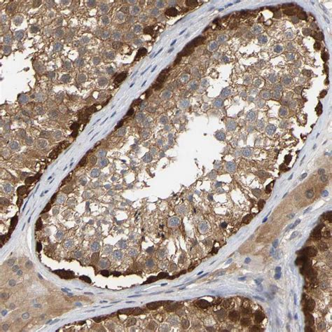 Rabbit Polyclonal Anti Mtpn Antibody Buy For Research Highly Specific Rigorously Validated