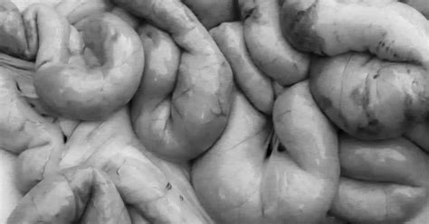 Can You Identify These Strange Century Old Objects