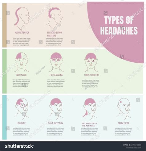 Infographic On Different Types Headaches According Stock Vector Royalty Free 2196341669