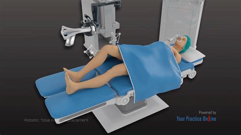 Robotic Total Knee Replacement Video Medical Video Library