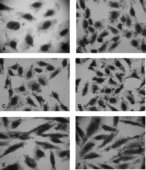 Localized Adherence Like Lal Patterns In Hep 2 Cells Of Download Scientific Diagram