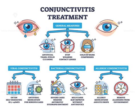 Conjunctivitis Or Pink Eye Symptoms With Medical Examples Outline Diagram Vectormine
