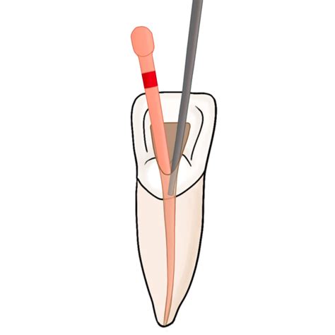 Cdca Adex My Dental Key