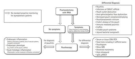 Pouchitis In Inflammatory Bowel Disease A Review Of Diagnosis Prognosis And Treatment Pmc