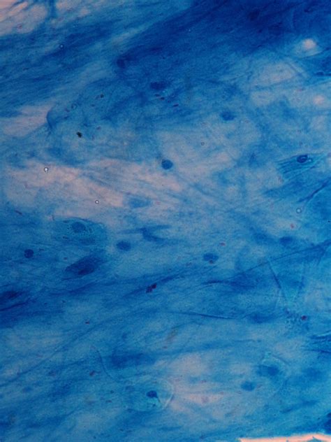 Tuberculosis Classification Object Detection Dataset By Shriyanr