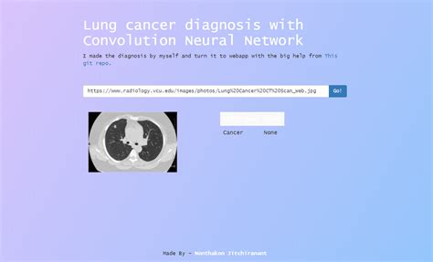 GitHub nonkung51 lung cancer diagnose AI วนจฉยมะเรงปอดดวย Keras และ Flask https medium