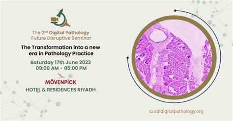 Abdulaziz Alajlan Posted On Linkedin