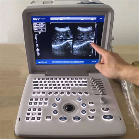 Full Digital Ob Gyn Usg Scan Machine 0 To 120db 12in Led Display