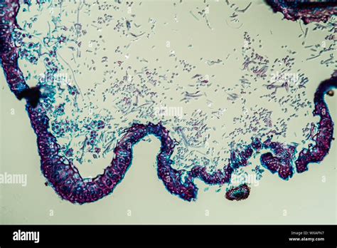 Lichen Cross Section