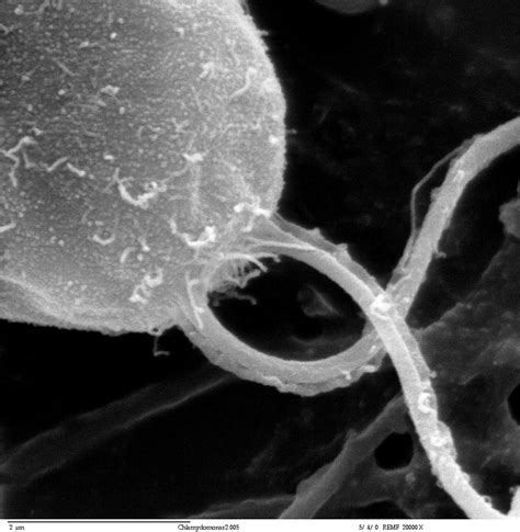 Scanning Electron Microscope Image Showing An Example Of Green Algae Chlorophyta