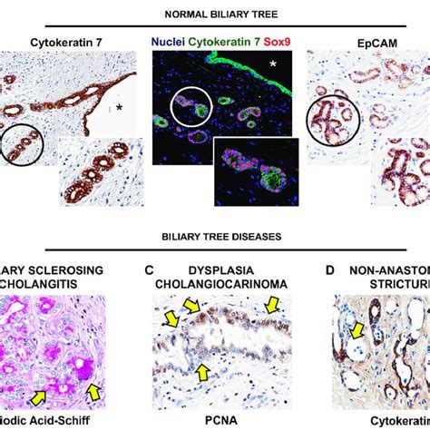 Biliary Tree Stemprogenitor Cells Btscs And Peribiliary Glands