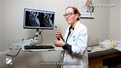 Posterior Cervical Spine Surgery Explained Dr Sheila Smitherman