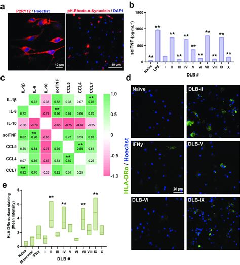 Different Dlb Csf Amplified α Synuclein Fibril Mixtures Cause