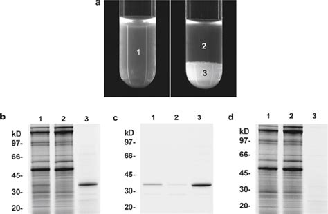 Aqueous Two Phase Separation Atps Of The Gfphfbi Fusion Protein From