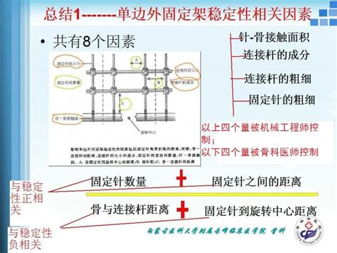 外固定支架的力学原理，3分钟学会！ 德医医学 助力医学教育发展！