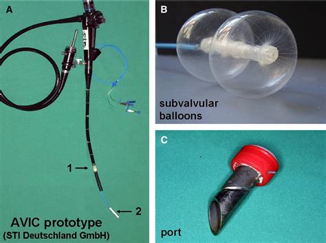 Figure 1 From Percutaneous Aortic Valve Replacement Endovascular