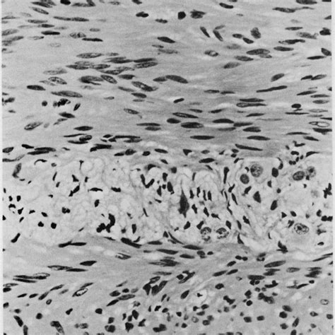 Auerbach S Plexus Ganglion Cells Showing Vacuolation Of The Cytoplasm Download Scientific