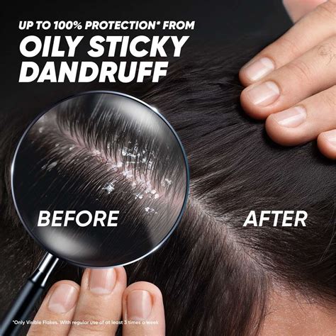 Head And Shoulders Deep Cleanse Dandruff Shampoo For Oily Scalp