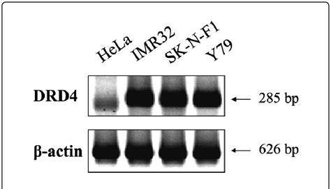 Drd4 Gene Pattern Band Formation In Patients With Adhd Download