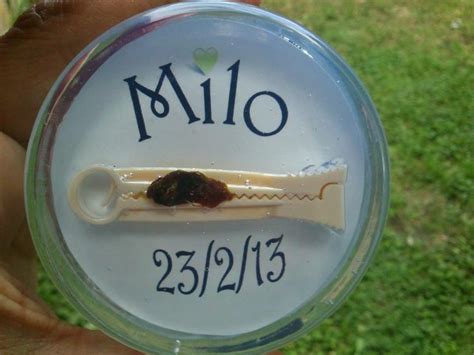 Umbilical Cord In Resin Resin Crafts Resin Resin Art
