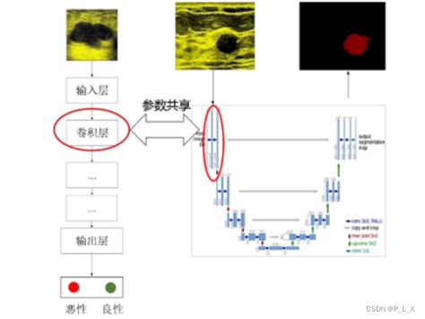 深度学习论文精读01——基于多任务学习的肿瘤医学影像语义分割与分类研究医学影像 语义分割 组织病理 Csdn博客