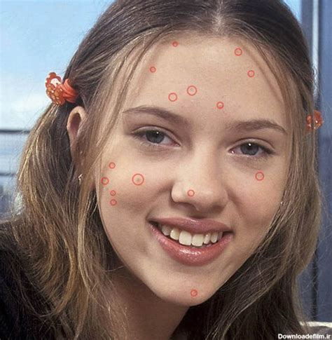 عکس دختر با صورت پر جوش