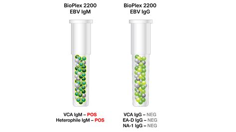 Bioplex 2200 Ebv Panels Bio Rad