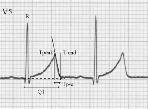 Measurement Of Qt And Tp E Intervals The End Of The T Wave Was Measured