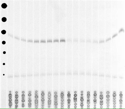 When Running A Tlc Assay Samples Are Running At Different Speed On The