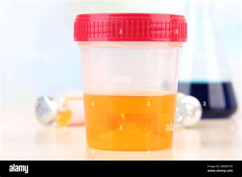 Medical Urine Test Close Up Stock Photo Alamy