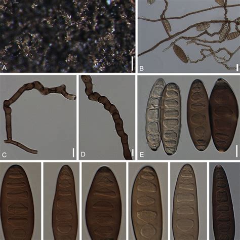 Bipolaris Crotonis Imi 223682 A Aerial View Of Culture B Conidia Download Scientific