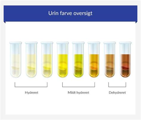 Urine Color Chart Whats Normal And When To See A Doctor Urinal Module