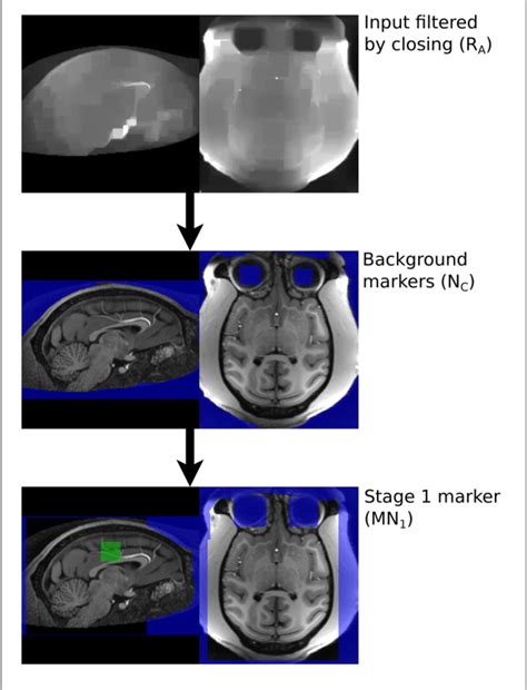 Figure 1 From Brain Extraction Using The Watershed Transform From Markers Semantic Scholar