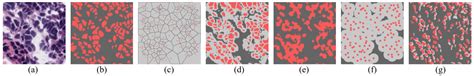 논문 리뷰 Dynamic Pseudo Label Optimization In Point Supervised Nuclei Segmentation