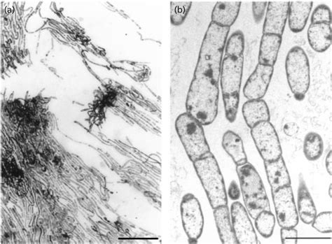 Turicibacter Sanguinis Mucosal Immunology Lab Bacterial Database Github Wiki