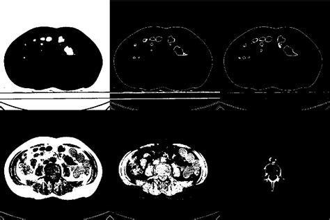 Image Enhancement And Morphological Operations On Images With Matlab