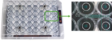 Real Time Visualization Of Platelet Aggregation And Adhesion
