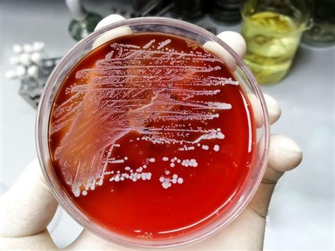 Crecimiento De Bacterias En La Sangre Columbia Agar Medio Base