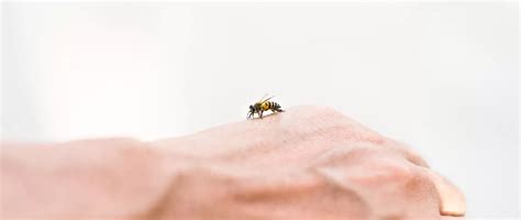 What Is Good For Bee Sting One Dose