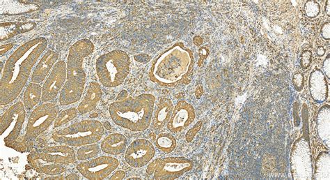 Cytochrome C Antibody 10993 1 Ap Proteintech