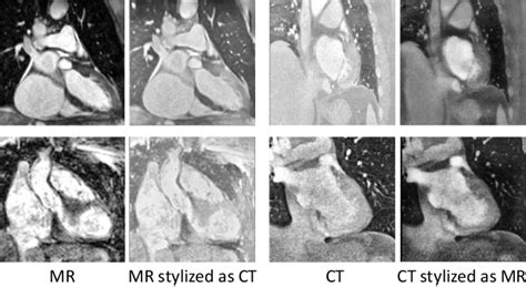 Figure 1 From Synergistic Image And Feature Adaptation Towards Cross Modality Domain Adaptation