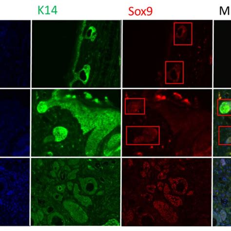 Strong Sox9 Staining Was Restricted To Hair Follicles In Mock Infected Download Scientific