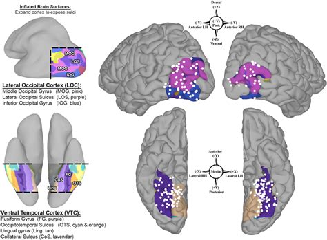 population coverage of higher level visual cortex bilateral