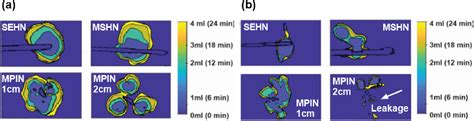 Figure 7 From X Ray Imageable Drug Loaded Hydrogel That Forms At Body Temperature For Image
