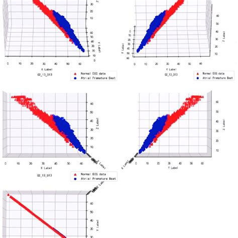 Three Dimensional Combination Maps Of Normal Ecg Data And Atrial
