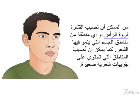 Dandruff In Arabic Ipam Power Hub
