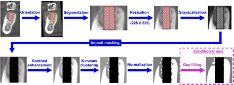 Figure 1 From Classification Of The Implant Ridge Relationship